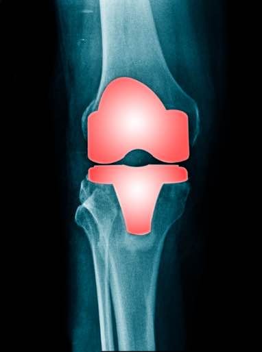 Sunnyvale Sports Medicine Orthopedic Center