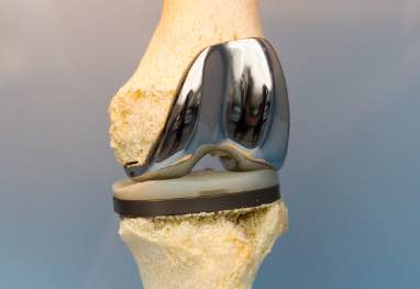 Sunnyvale Sports Medicine Orthopedic Center