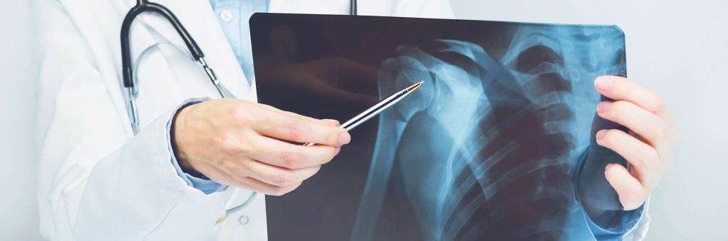Shoulder Injury Specialist in Dallas TX - Dr John Hibbitts M.D