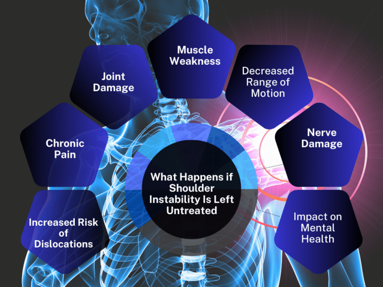 What Happens if Shoulder Instability Is Left Untreated